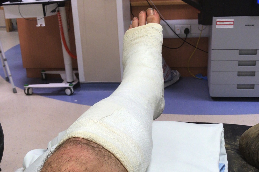 OUCH! Loosedog Lewis dislocating his ankle [FULL VERSION] - MBR