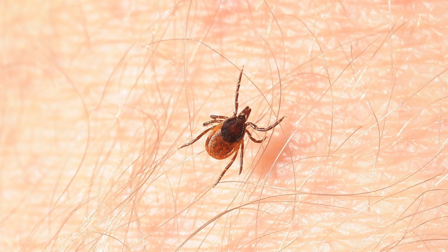 Everything mountain bikers need to know about ticks and how to remove ...