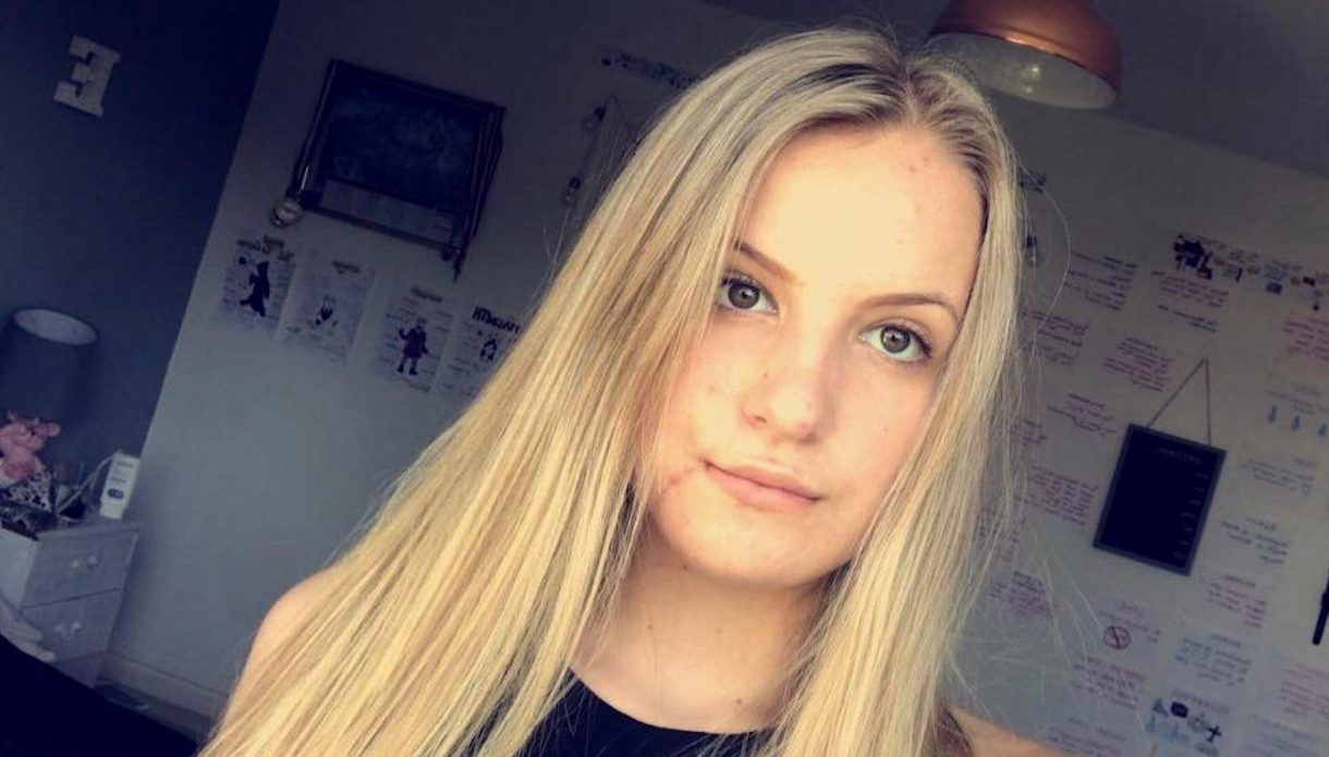 Calls for surgeon who rebuilt young rider’s face to be knighted - Horse ...