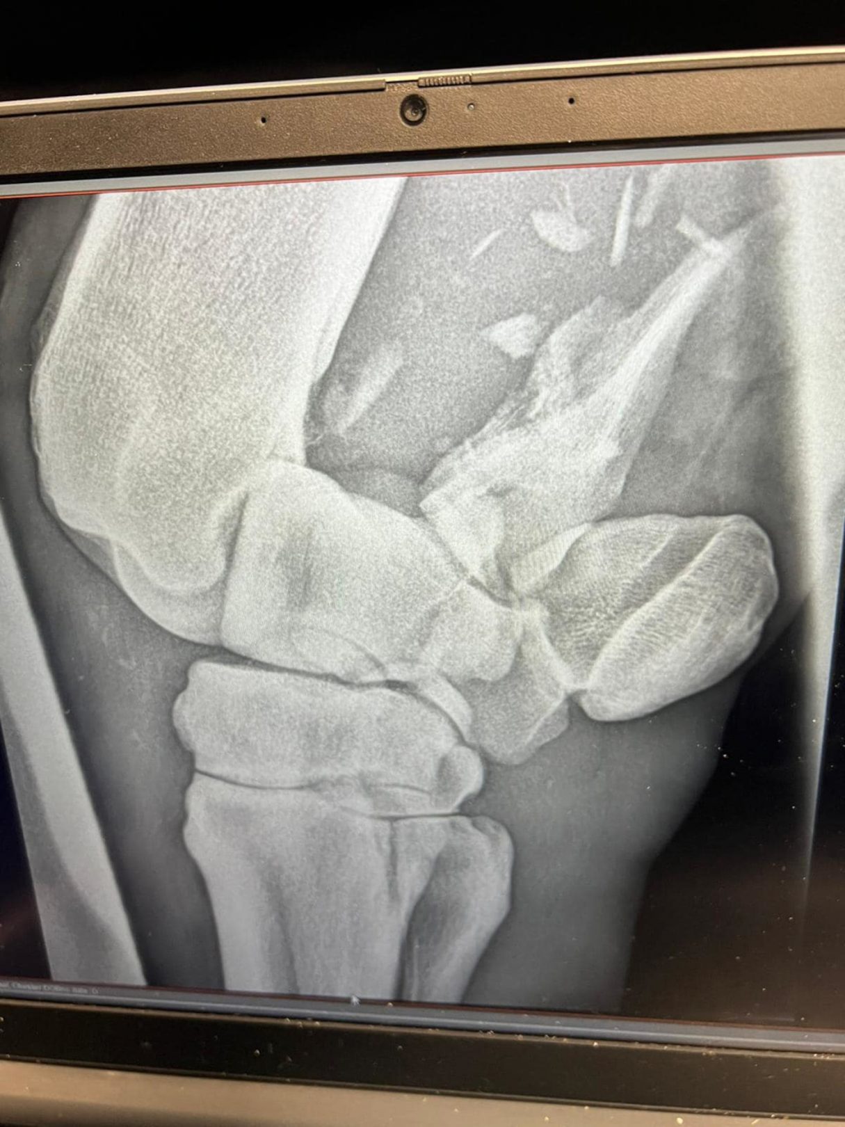 Vet’s haynet warning as stuck horse shattered leg - Horse & Hound