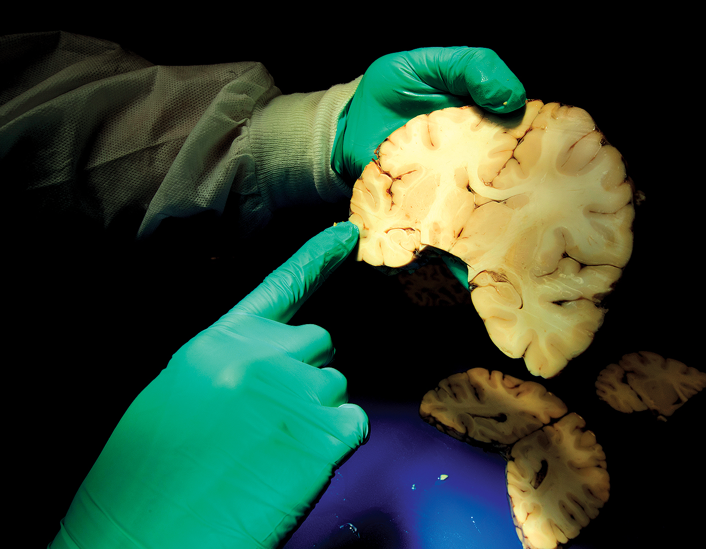 The science of brain injuries in rugby - Rugby World